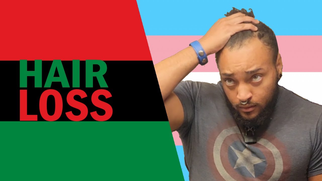 I Hated My Black Hair & Now I'm Losing it | Hair as a Black Trans Man ...
