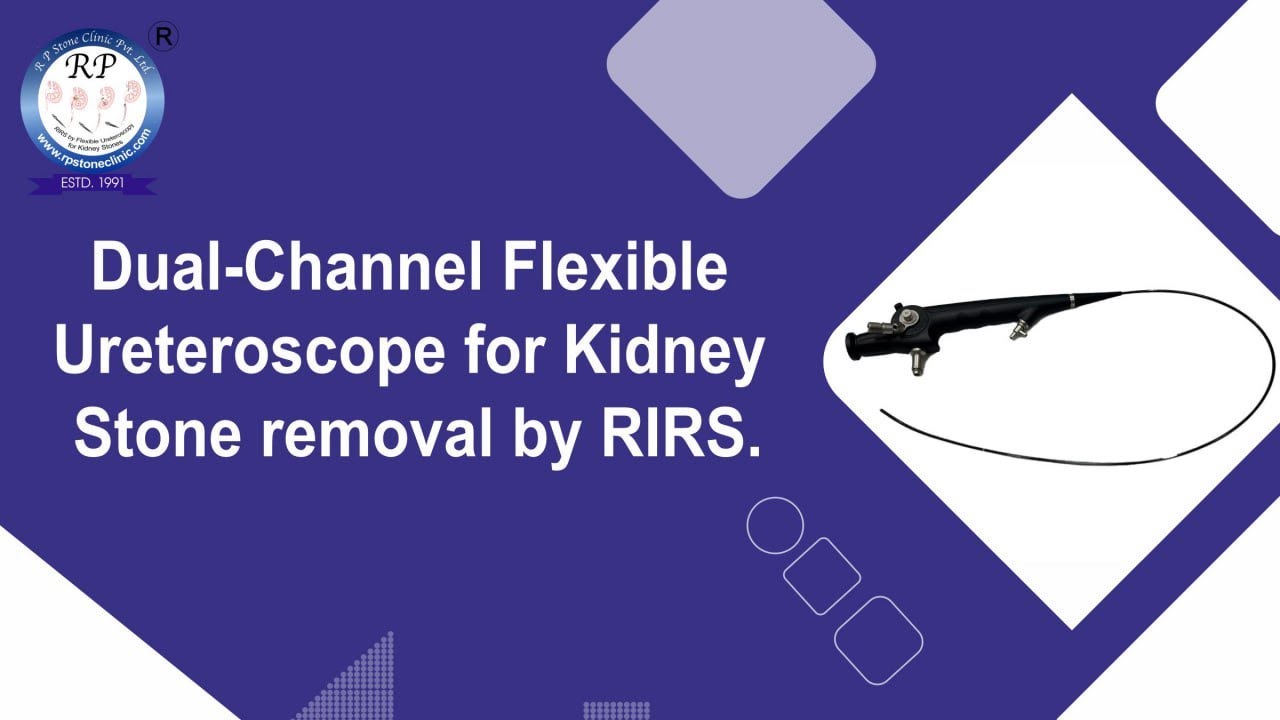 Dual-Channel Flexible Ureteroscope for Kidney Stone Removal by RIRS ...