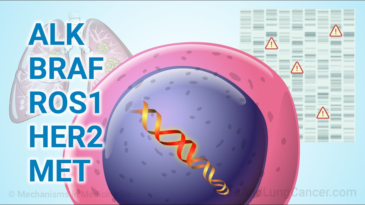 Understanding NSCLC Treatments for Less Common Mutations: ALK, BRAF ...