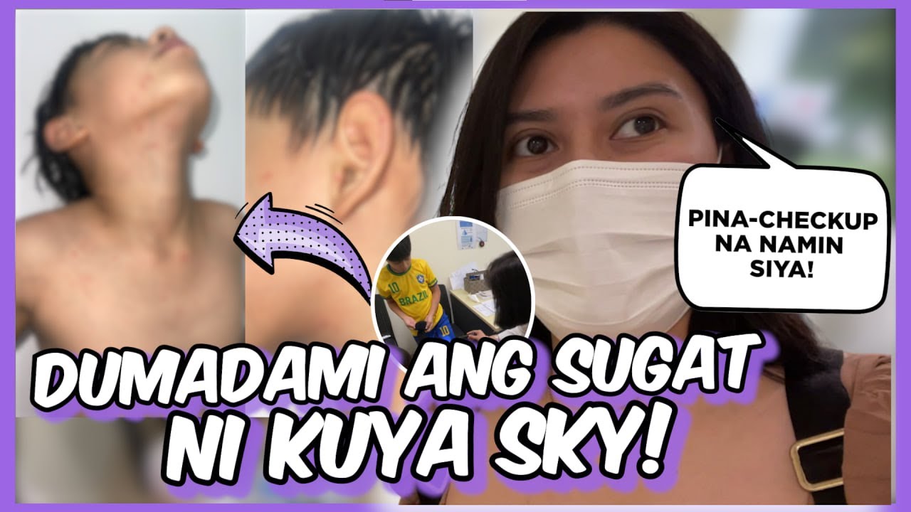 NAGKASUGAT ANG BUONG KATAWAN NI SKY (Pinacheck up na namin sa Doktor) 💜 ...