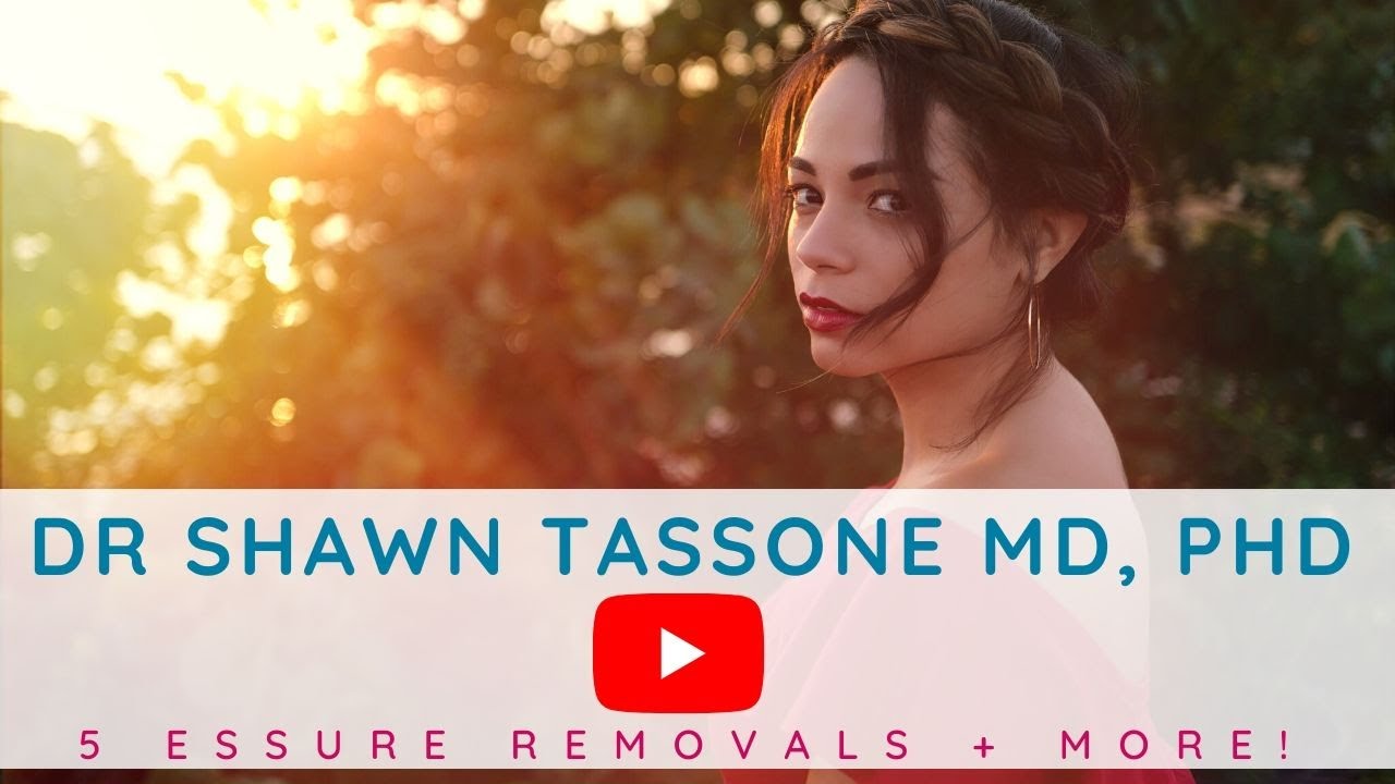 Essure Removal: 5 Cases PLUS An Interesting Story - YouTube