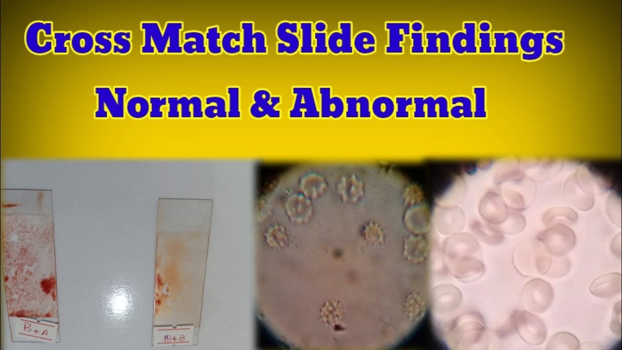 Cross Match Slide Findings Microscopy Compatibility Cross Match Slide Findings Microscopy Compatibility