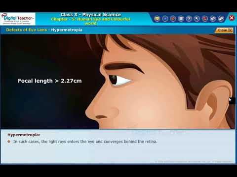 Defects of Eye, Human Eye Colourful world Class 10 Physics - YouTube