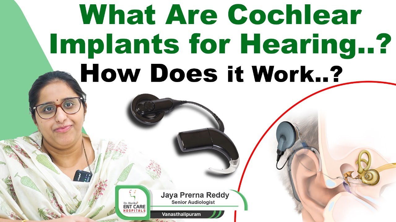 What Are Cochlear Implants for Hearing | How Does Cochlear Implants ...