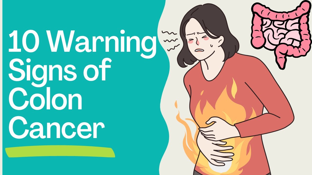 10 warning signs of colon cancer: Don't Ignore - YouTube