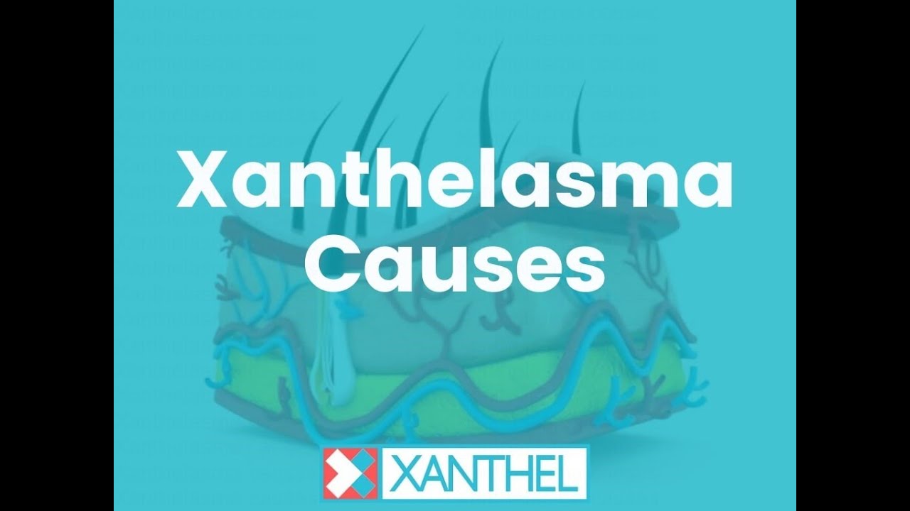 XANTHELASMA CAUSES, What are the cause of Xanthelasma and Xanthomas? - Brought To You By XANTHEL ...
