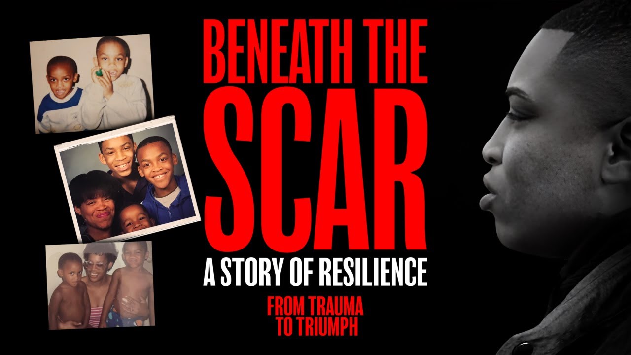 BENEATH THE SCAR | FULL FREE DOCUMENTARY | SHOCKS AND DOCS - YouTube