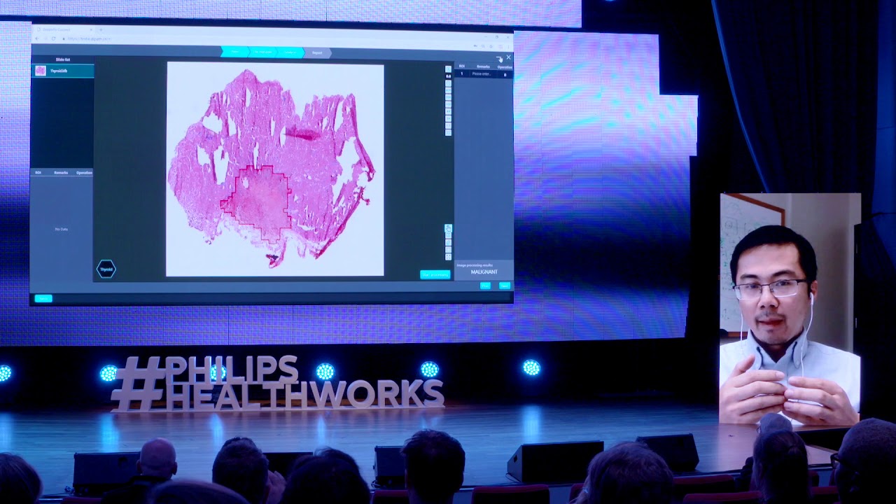 Presentation by Deep Informatics during Breakthrough Day - YouTube