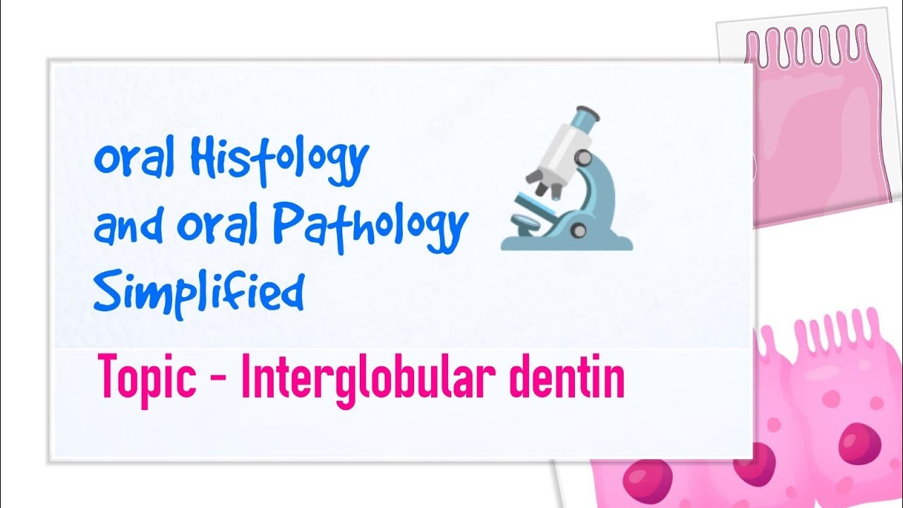 Interglobular dentin || Oral pathology diagram - YouTube