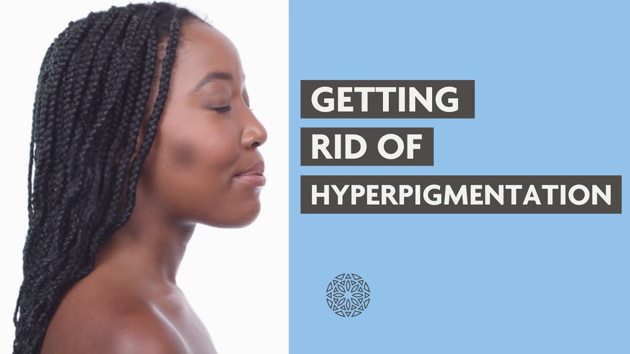 How to Get Rid of Hyperpigmentation on African American Skin - YouTube