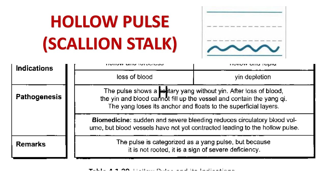 HOLLOW PULSE (SCALLION STALK) CLINICAL SIGNIFICANCE - YouTube