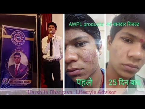 Awpl products result | pimples || Harshita Bhargava || # ...