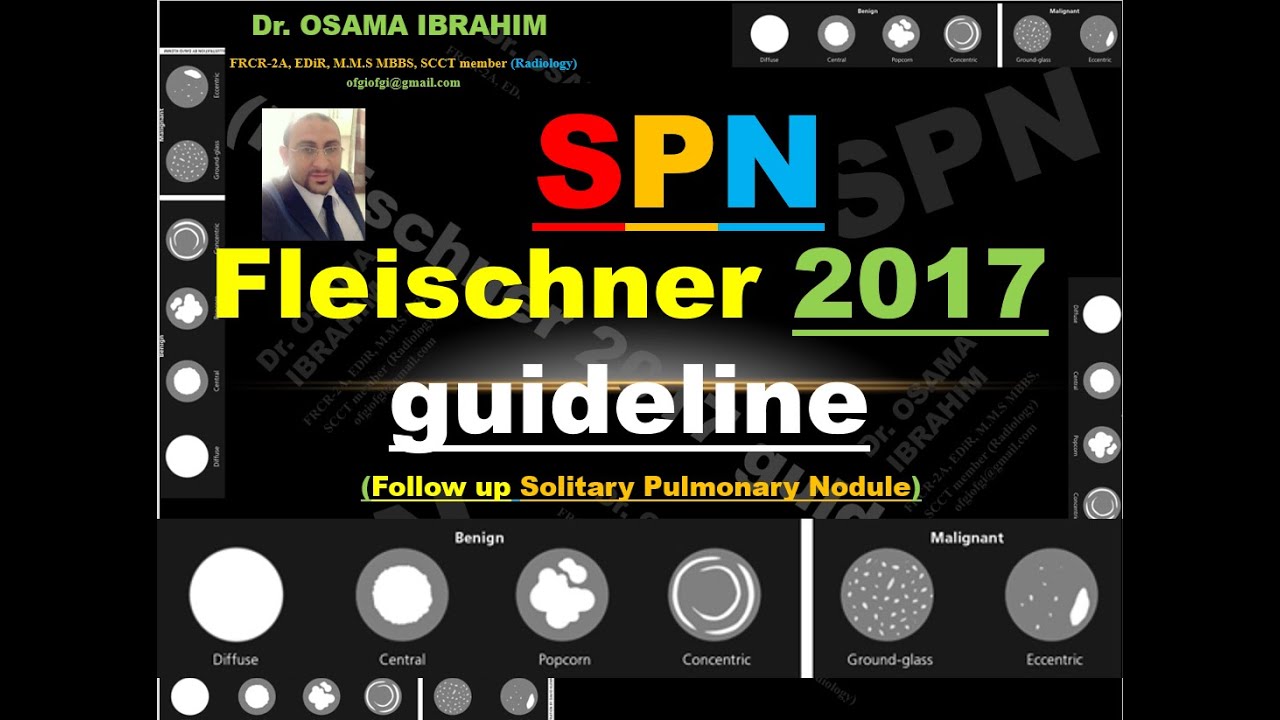 Fleischner 2017 guideline and how to follow up solitary pulmonary ...