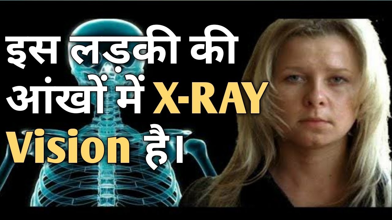 इस लड़की की आंखों में X-RAY Vision है। This girl has X-RAY Vision in ...