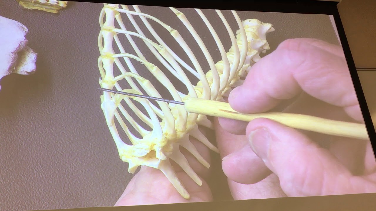 Facet vs. Demifacet - YouTube