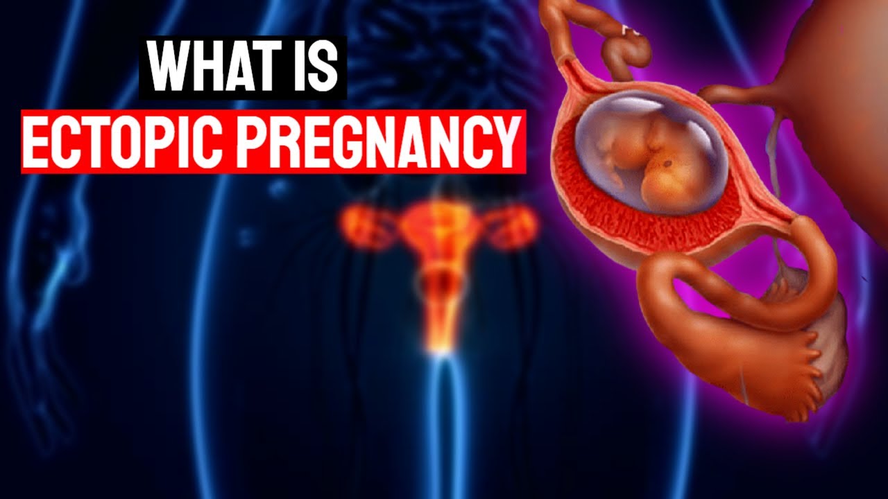 Atomic Pregnancy: Causes, Symptoms, and Treatment | You Need to Know ...