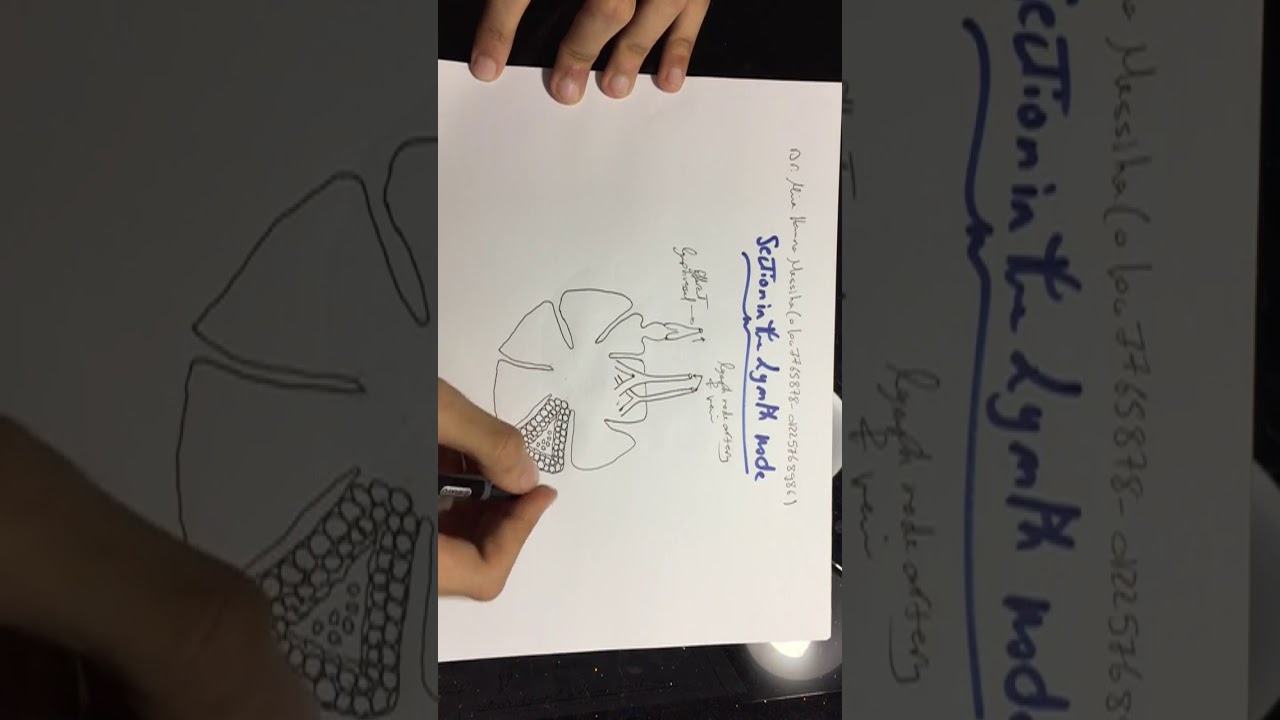 How to draw a Section in Lymph node - YouTube