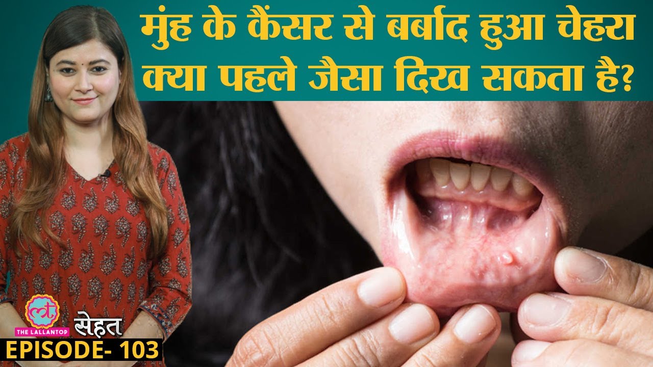 Oral Cancer के बाद Reconstructive Surgery से चेहरा कैसे ठीक किया जा