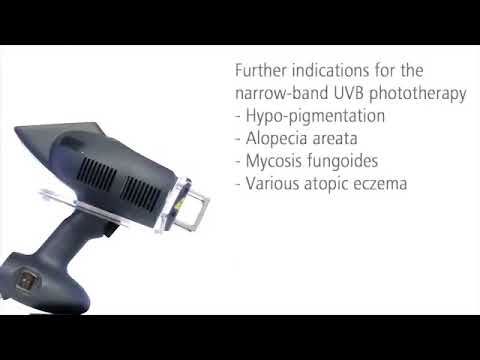 308nm Excimer UVB Therapy For Psoriasis And Vitiligo - YouTube
