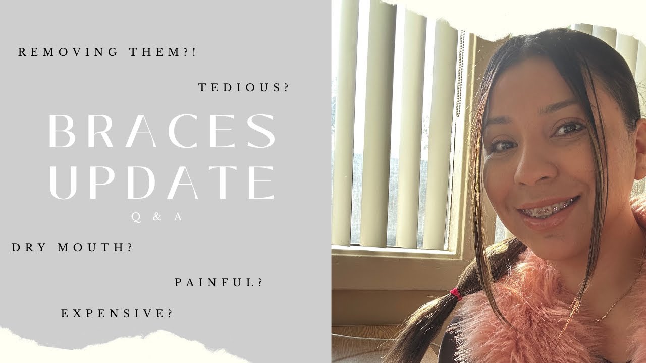 Q&A Braces Update | 10 Day Update Post Treatment - YouTube