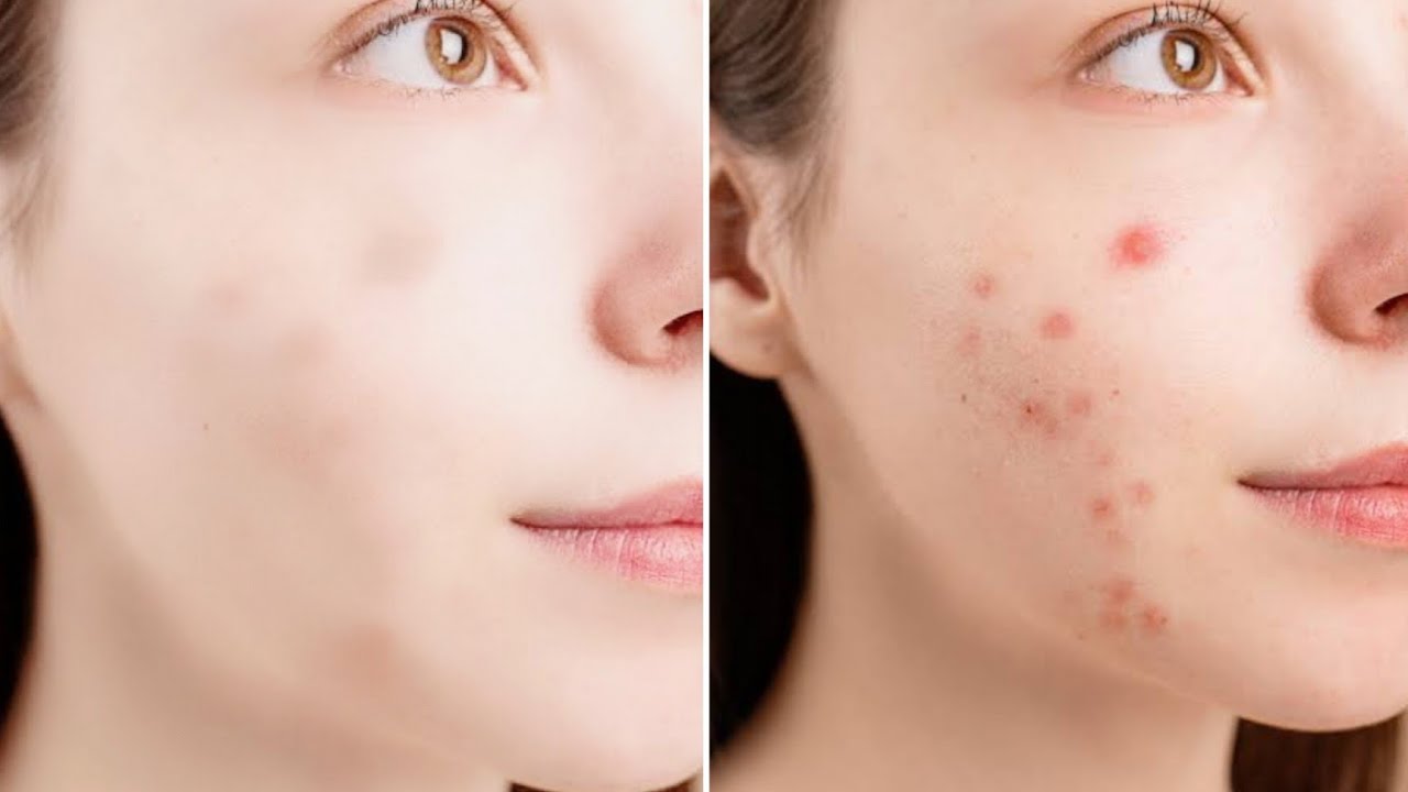 Body Editor Smoot+Face automatic Retouching Skin 😱 Auto Retouching Skin ...