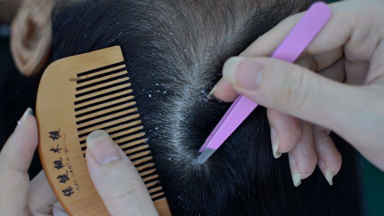 Asmr Relaxing Scalp Check ~ Wooden Comb ~ Tweezers ~ Scratching ...