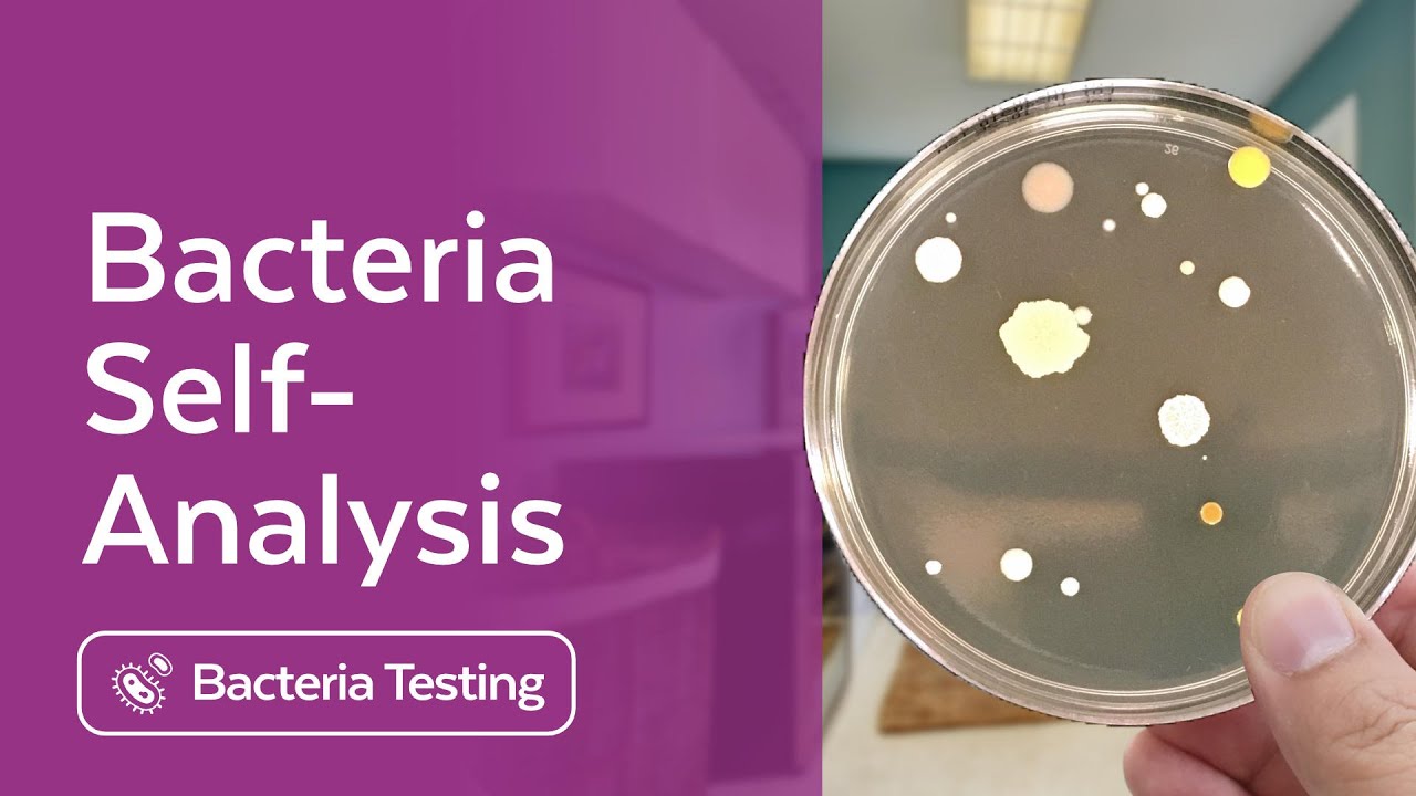Bacteria Plate Self Analysis (Mold Check Up with Bacteria) - YouTube