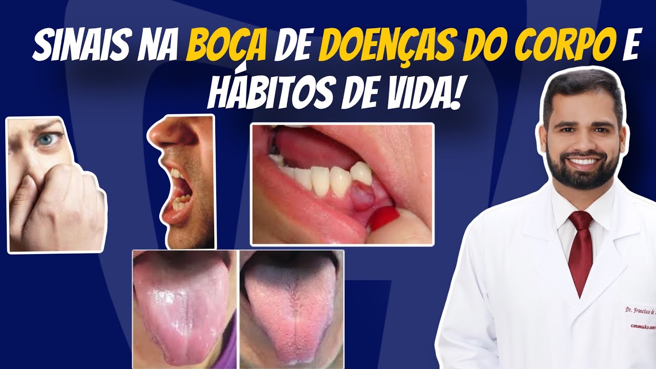 Sinais na boca de doenças do corpo e hábitos de vida! # ...