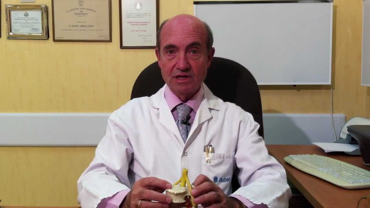 Hernia discal lumbar Dr. Carrillo - YouTube