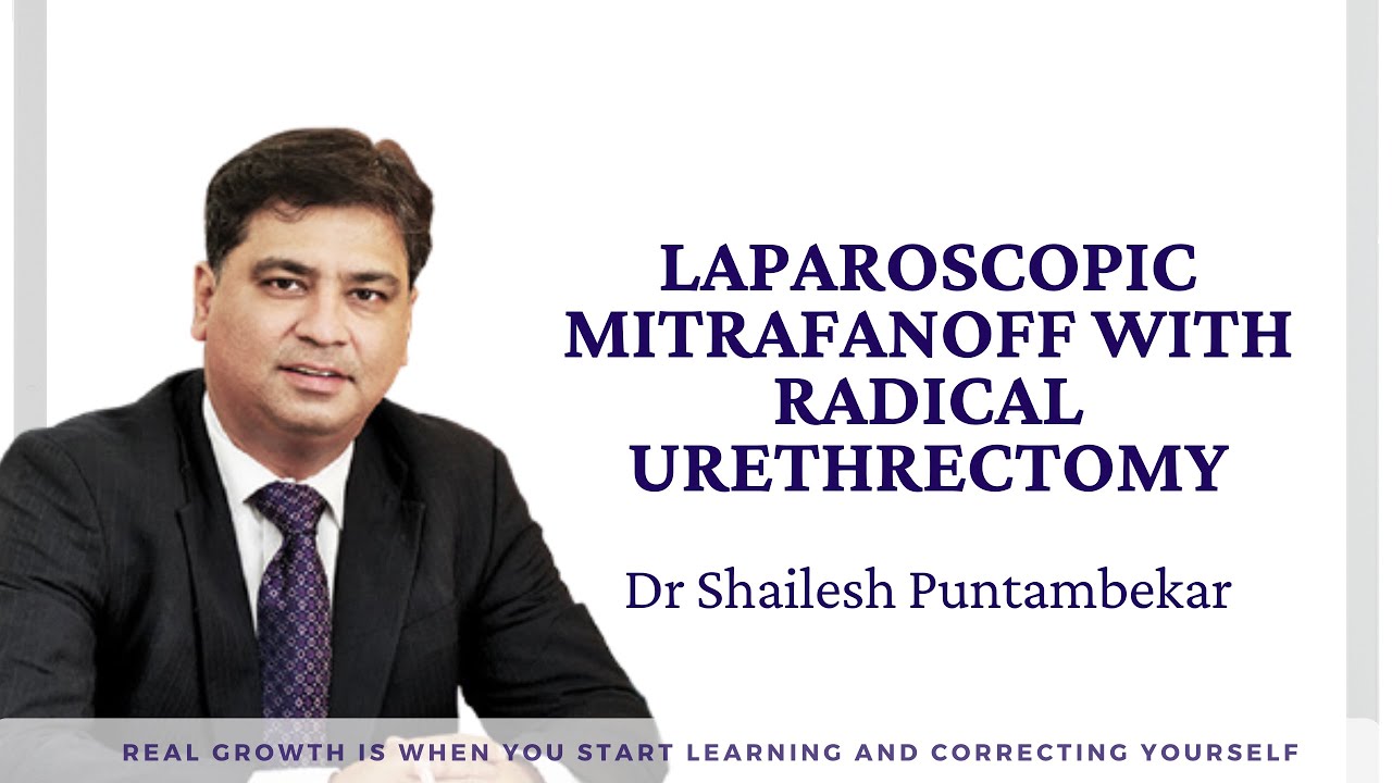 Laparoscopic Mitrafanoff with Radical Urethrectomy | Dr. Shailesh ...