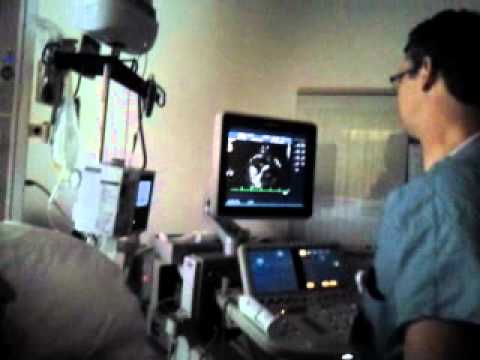 Heart eco gram - YouTube