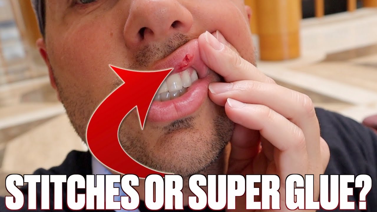 DAD BUSTS LIP WIDE OPEN ON KID'S HEAD SWIMMING ON VACATION WITH FAMILY ...