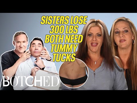 Sisters Get Tummy Tucks TOGETHER on Sagging Breasts & Fupa | Botched | E!