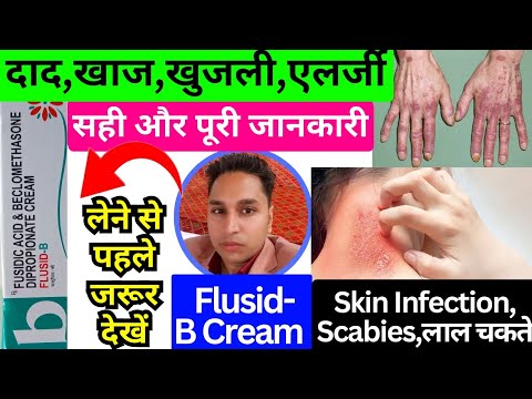 flusid b cream | flusid cream uses in hindi | flusid b cream uses in ...