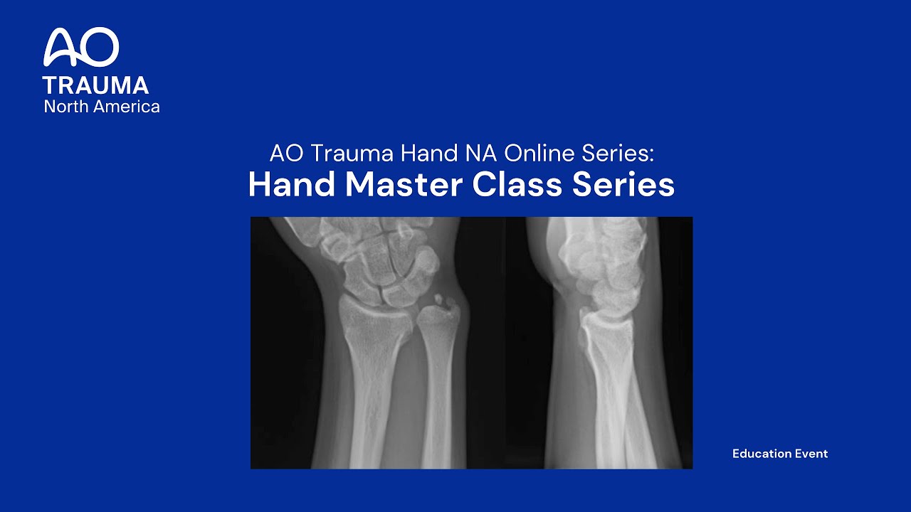 AO Trauma Hand NA Hand Master Class Series: Phalangeal/ Metacarpal ...