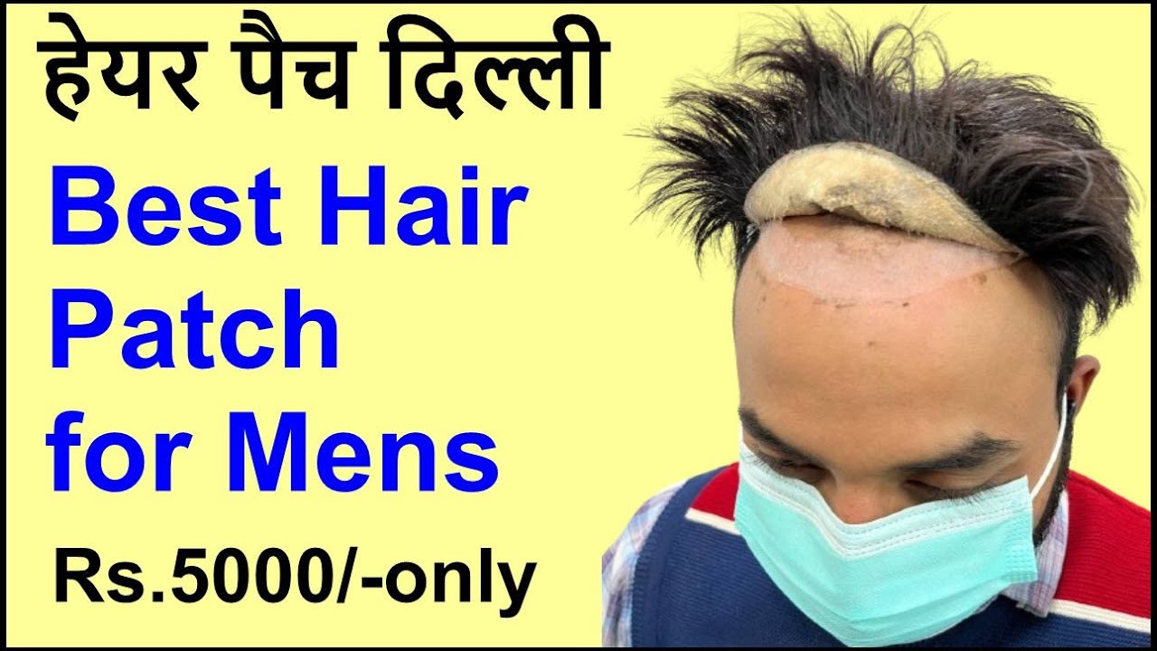 Hair Patches For Men | Hair Transformation | Hair Wig For Men | Natural ...