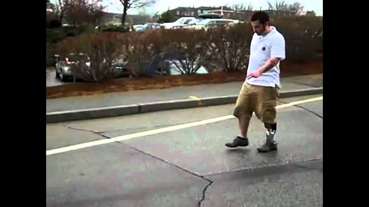 iWalk Bionic - Below Knee Prosthesis for Amputees 5.10.12 - YouTube