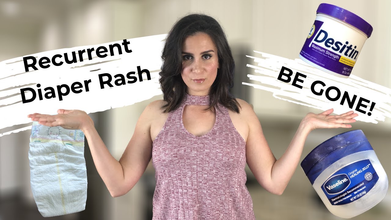 RECURRENT DIAPER RASH TREATMENT! Over-The-Counter Remedies - YouTube