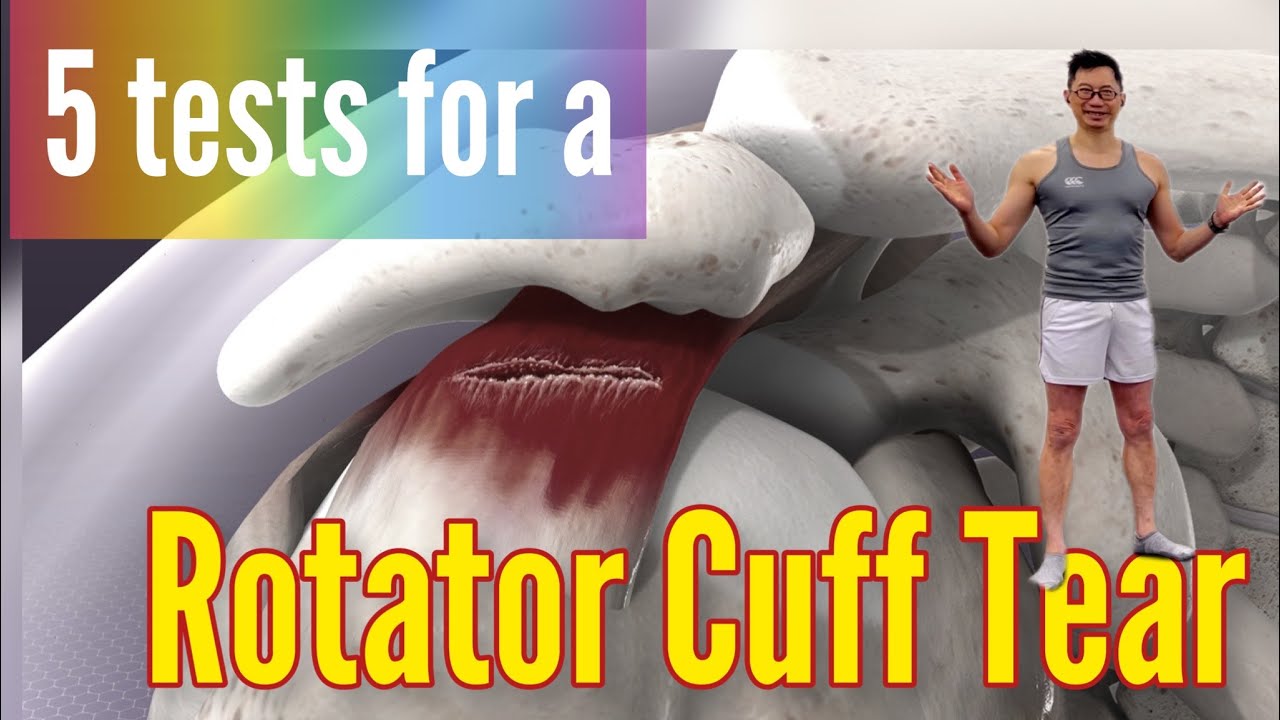 5 Special Drop arm test | 5 Easy Tests To Diagnose a Rotator Cuff - YouTube
