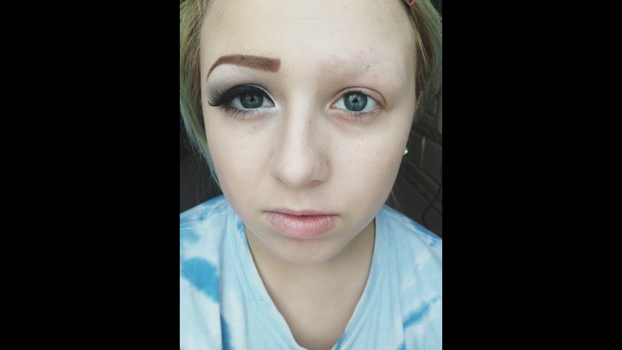 What Is Trichotillomania YouTube