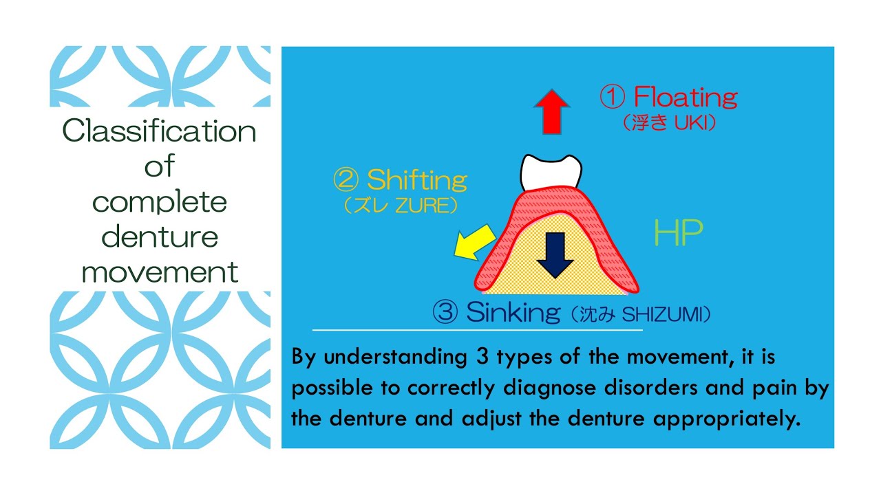 Classification of Complete Denture Movement - YouTube