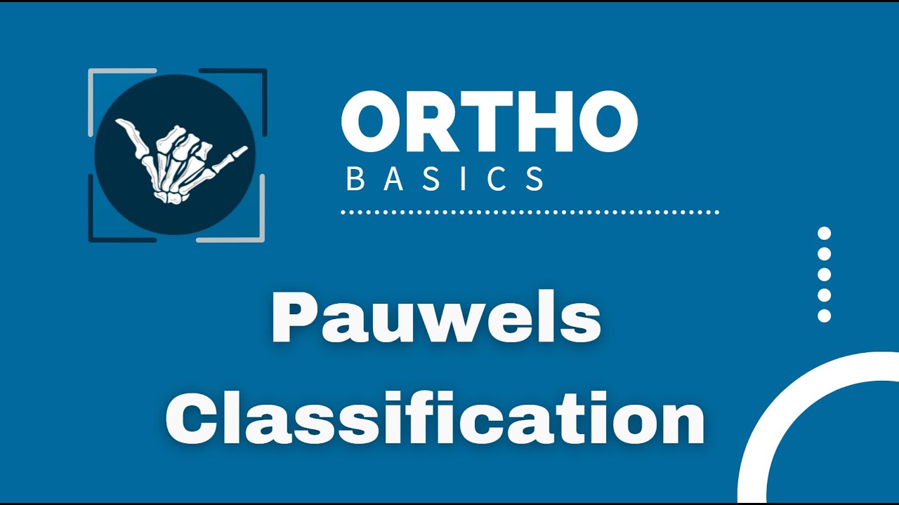 Ortho Basics: Pauwels Classification - YouTube
