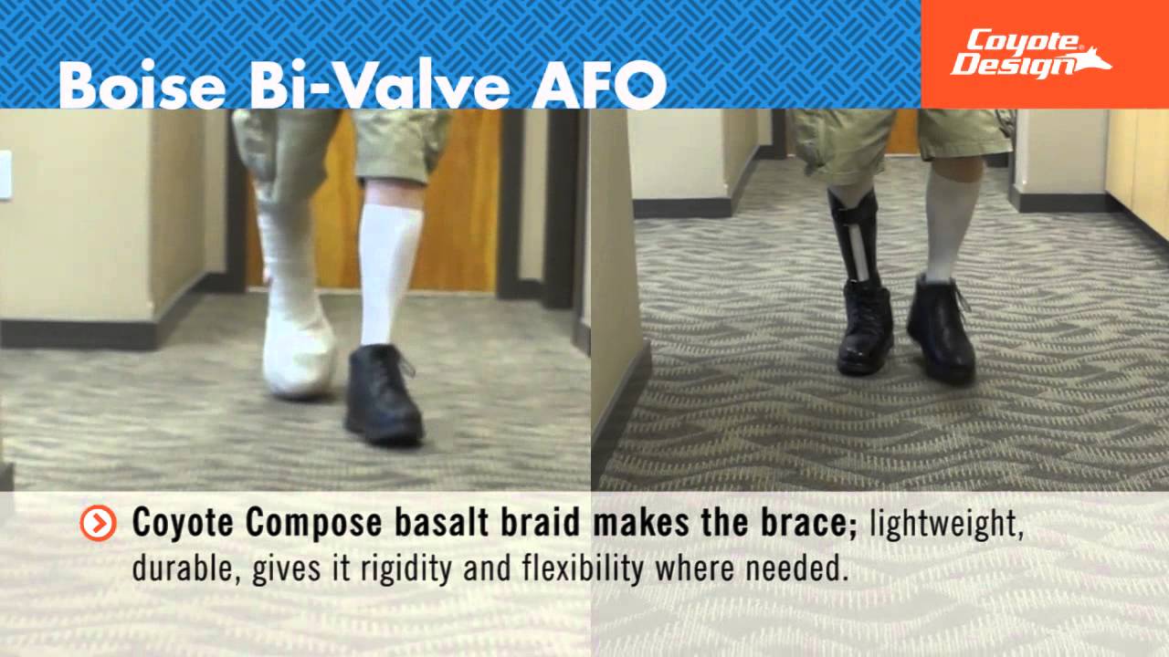 Coyote Prosthetics Boise Bi-Valve AFO - YouTube