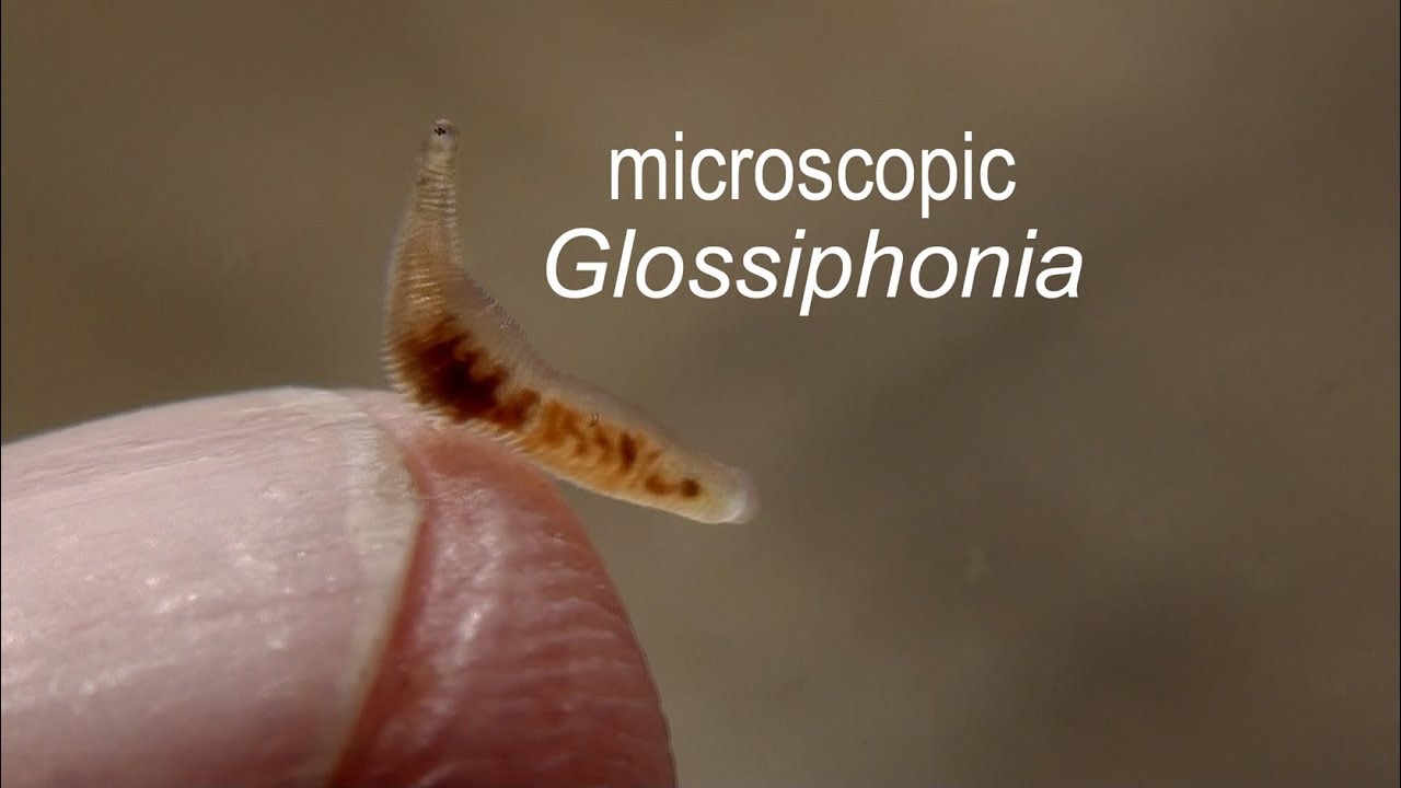 GLOSSIPHONIA microscopic - YouTube
