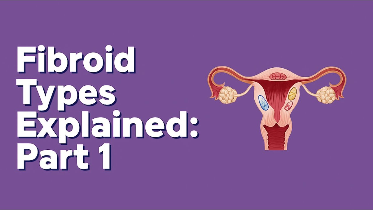 Subserosal Fibroids Explained: Symptoms, Causes & Treatment - YouTube