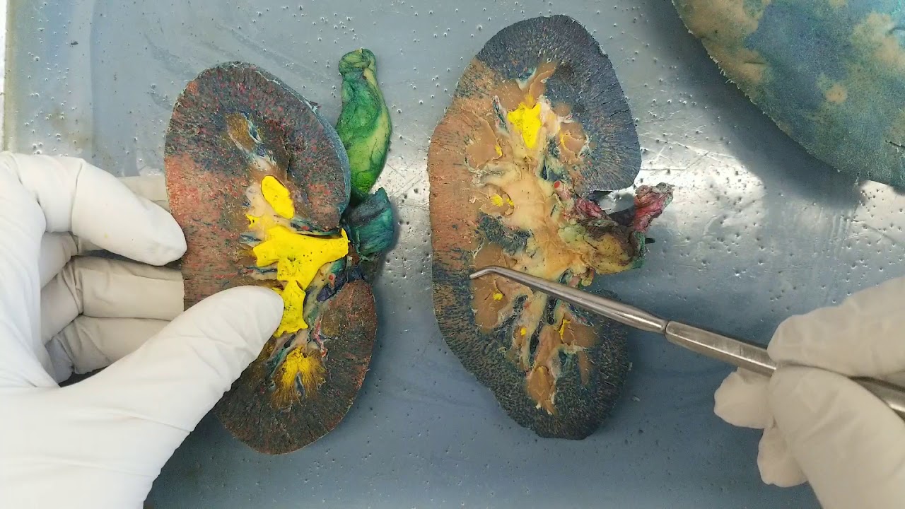 Kidney - pig, polymer-injected - YouTube