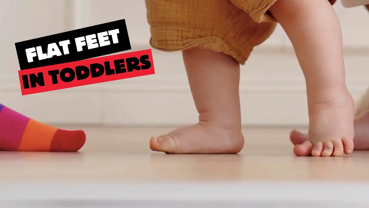 Does your child walk like this? Flat Feet in Toddlers - Podiatrist ...