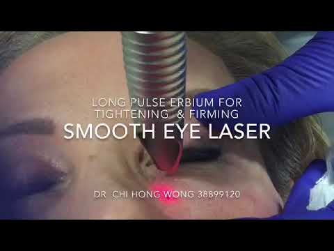 Fotona Smooth Eye Laser Brisbane - Laser to Tighten and Smooth Skin ...