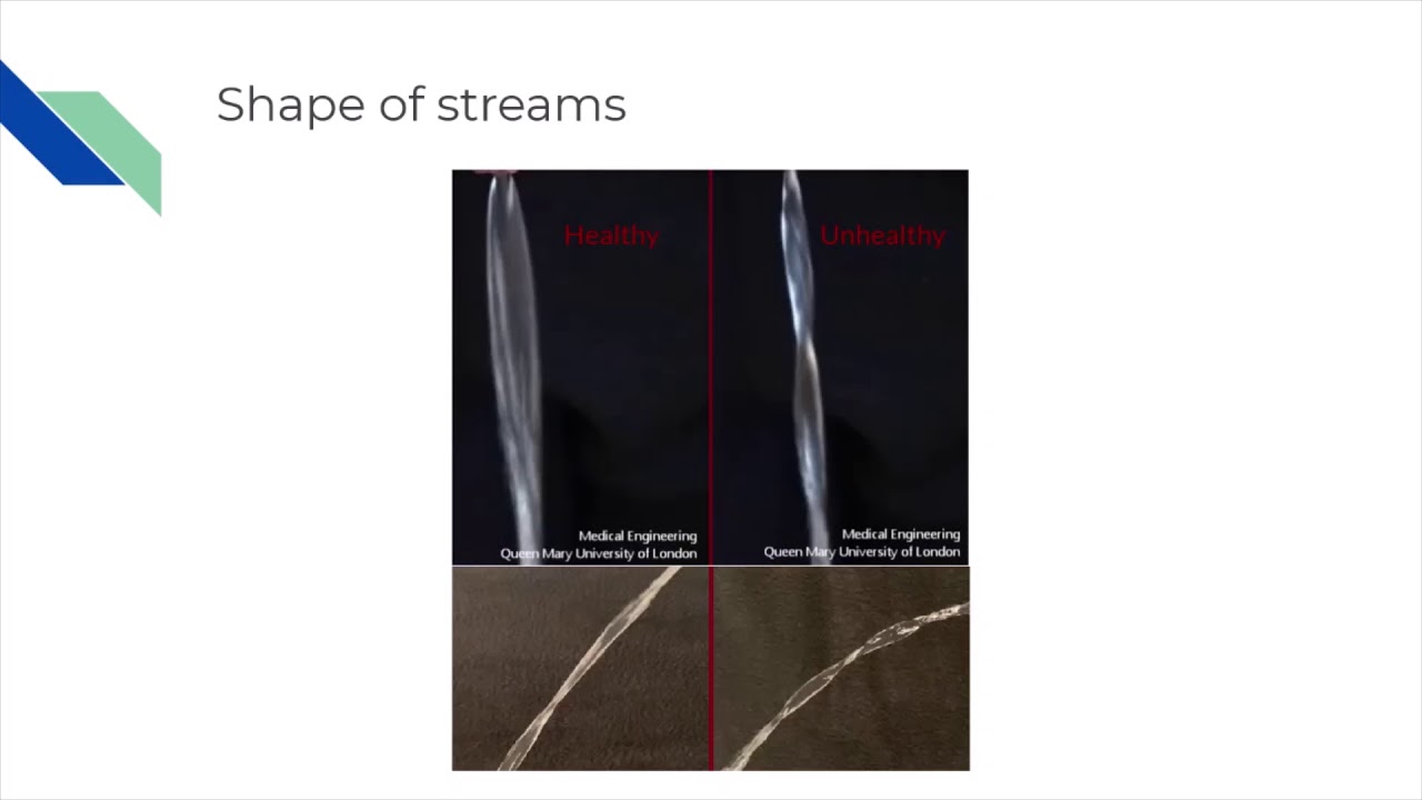 Applied Deep Learning WS2020: The shape of the urine stream - YouTube