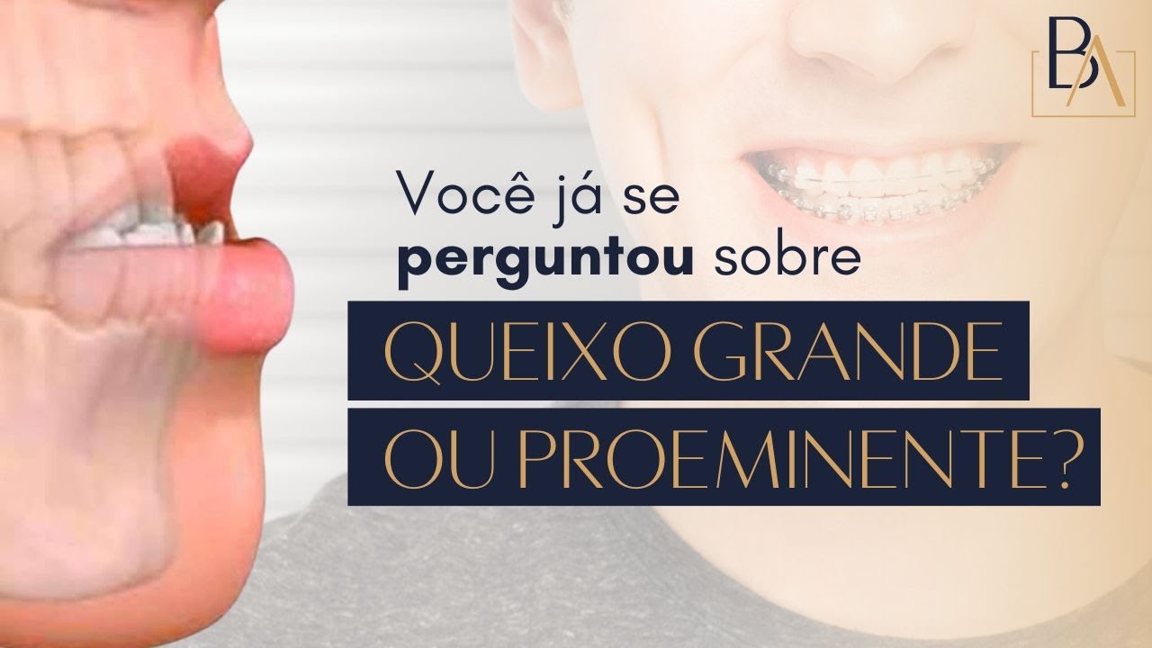 Você já se perguntou sobre queixo grande ou proeminente? - YouTube